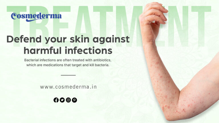 Bacterial Skin Infections : Causes, Types, Treatments & Prevention