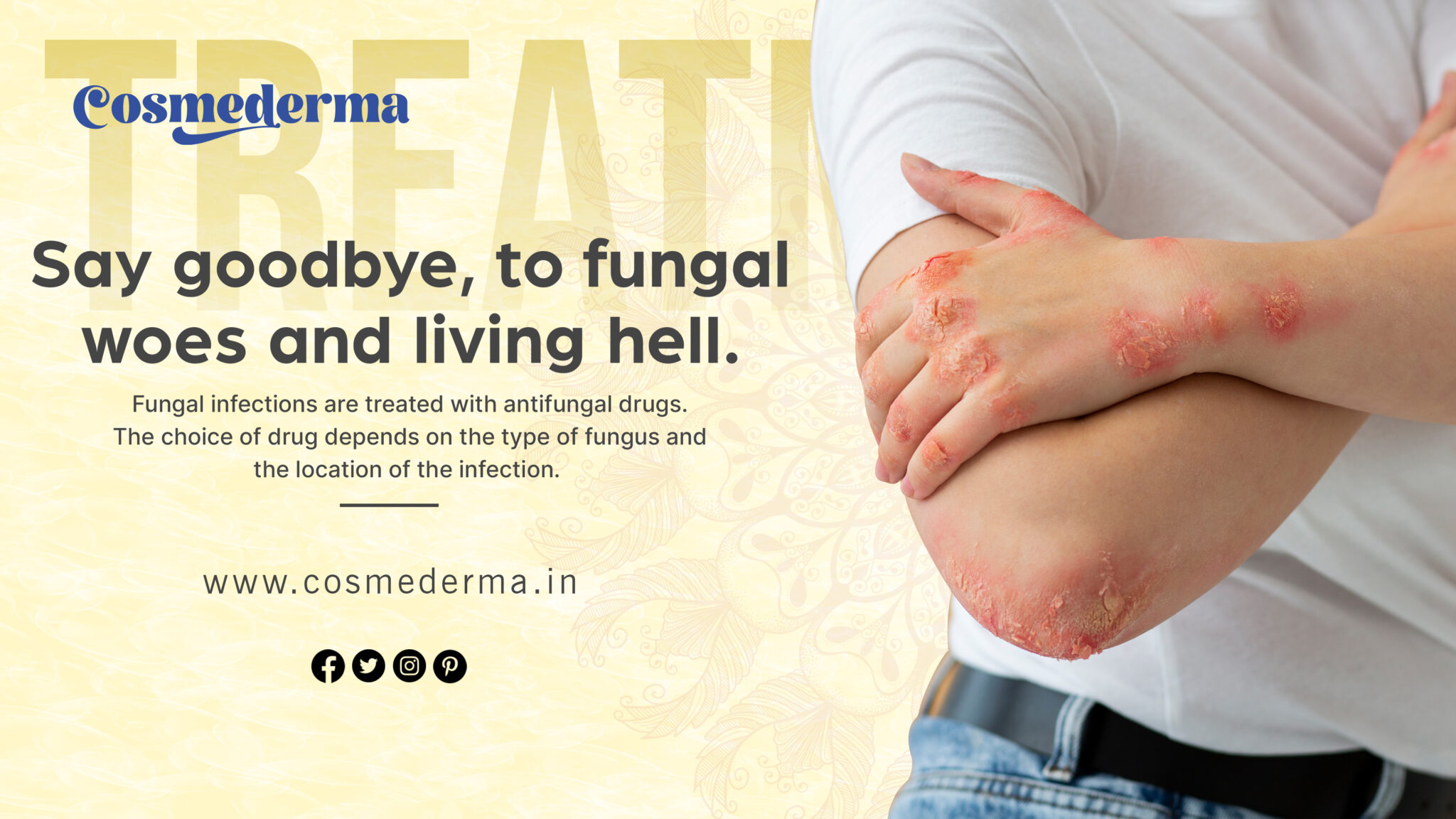 Fungal Infections : Causes, Types, Treatments & Prevention